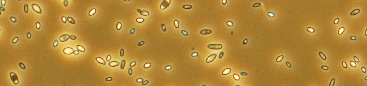 dekkera_bruxellensis_1280px - The Australian Wine Research Institute