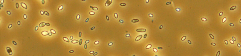 dekkera_bruxellensis_1280px - The Australian Wine Research Institute